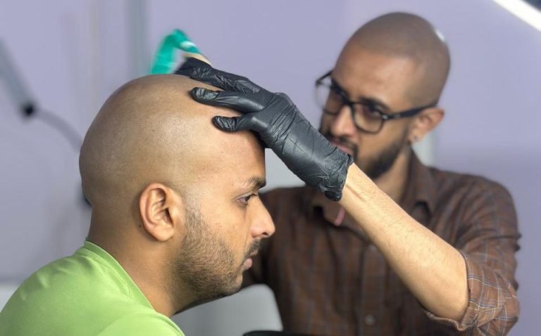Scalp Micropigmentation Process & Procedure: A Complete Guide